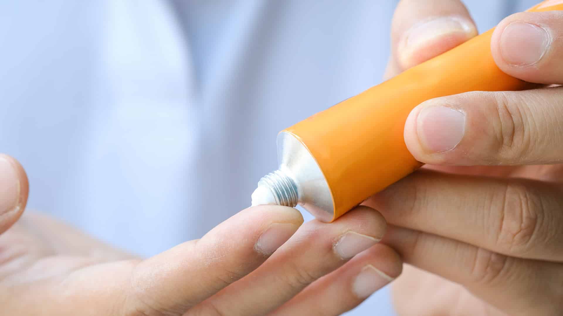 Clinical Importance of Topical Formulation Considerations in Treating ...